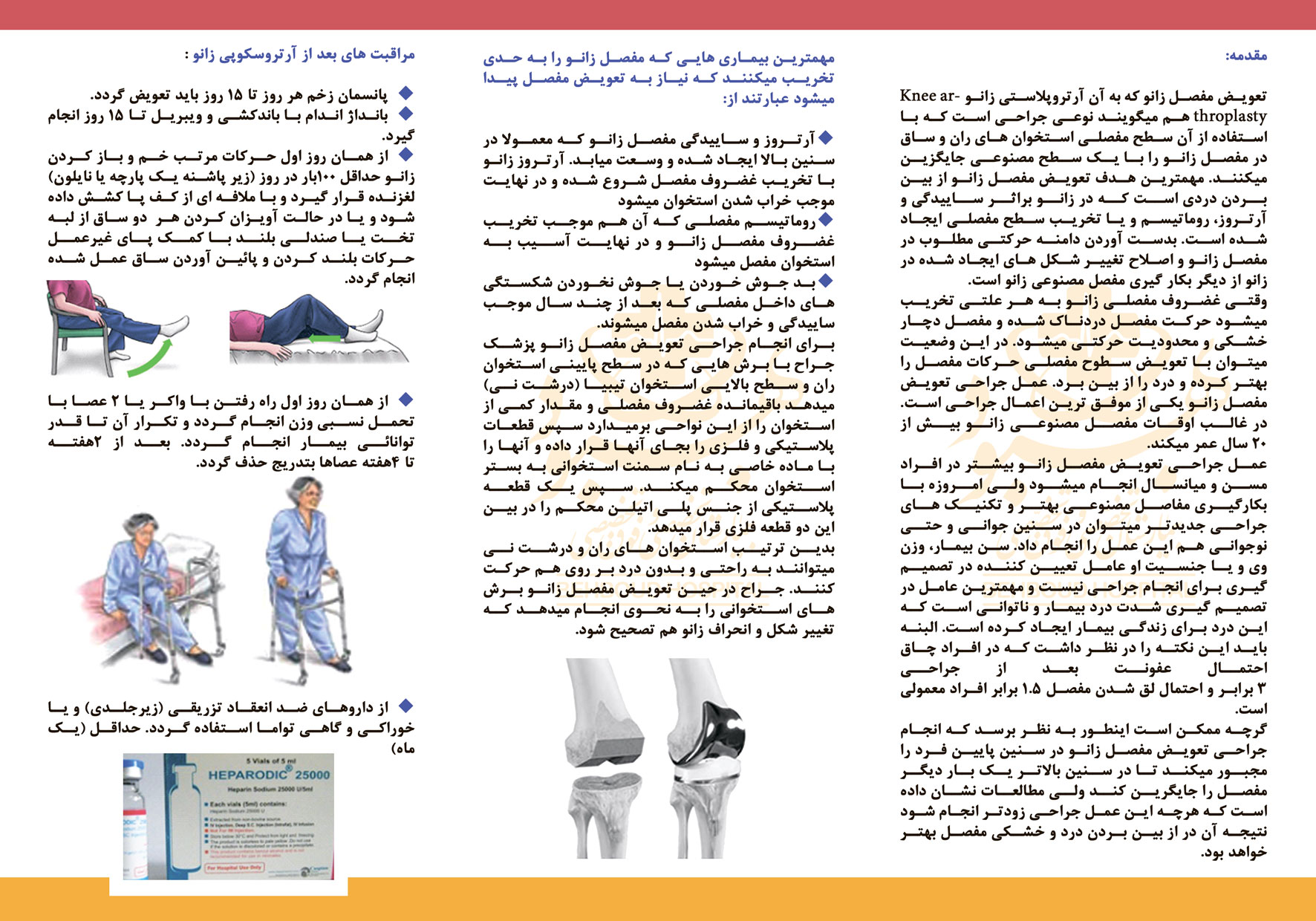 آرتروسکوپی زانو - بیمارستان بهبود